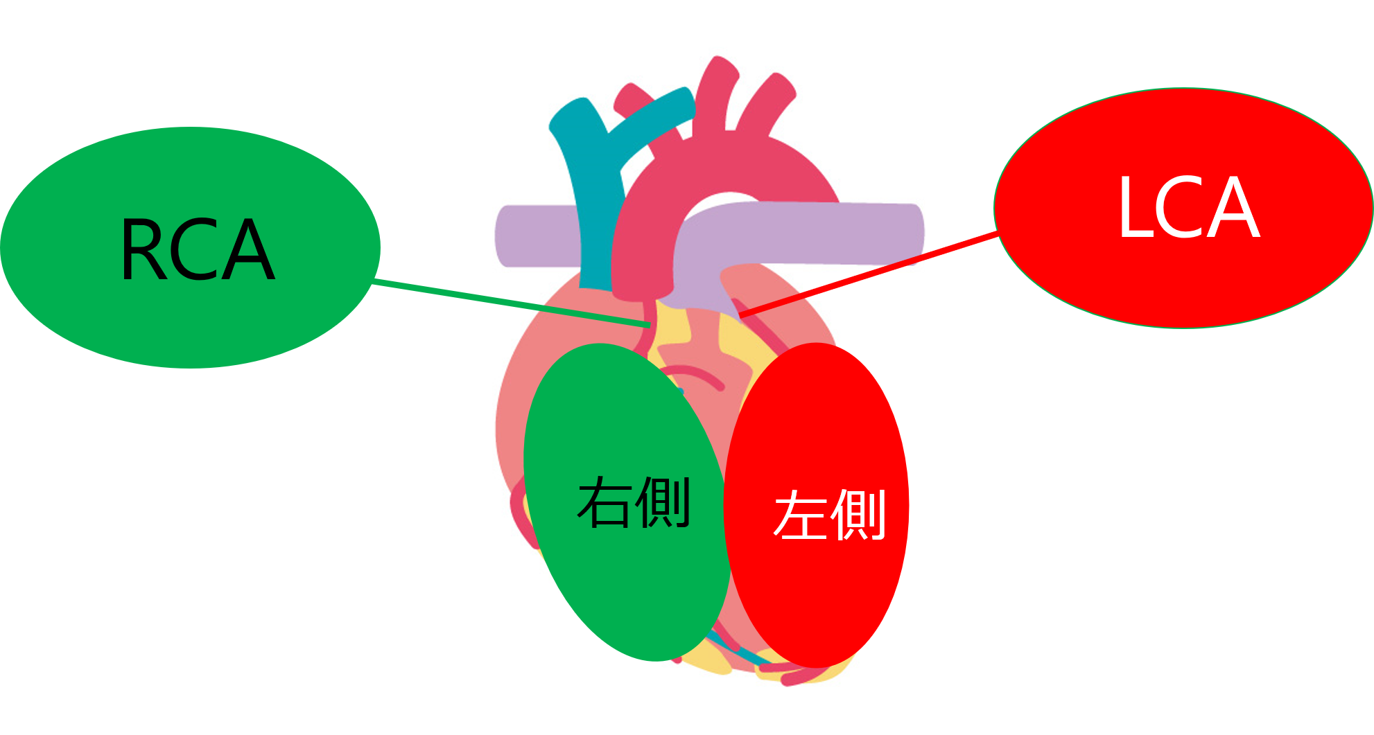 CABG（冠動脈バイパス術）パート① ～各グラフトの特徴＆術式の種類を解説～ | ICU看護師ダンカンの心外ブログ