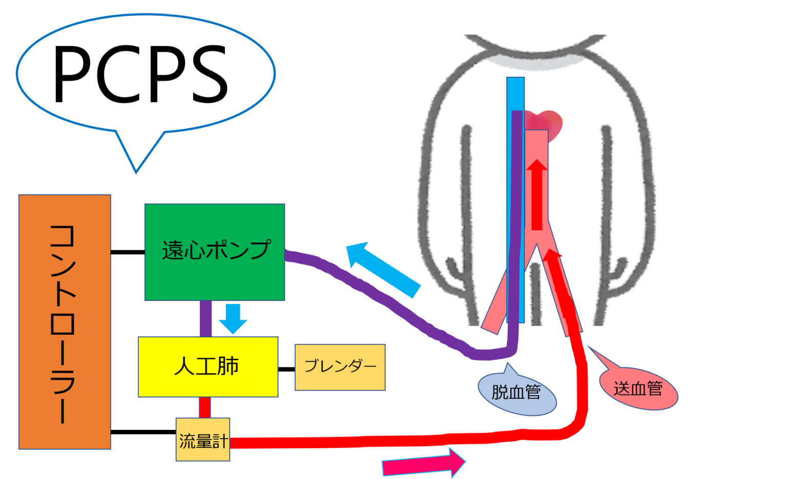 PCPS(VA‐ECMO)回路の観察ポイント ～安全に看護するためにPCPSを知ろう編～ | ICU看護師ダンカンの心外ブログ
